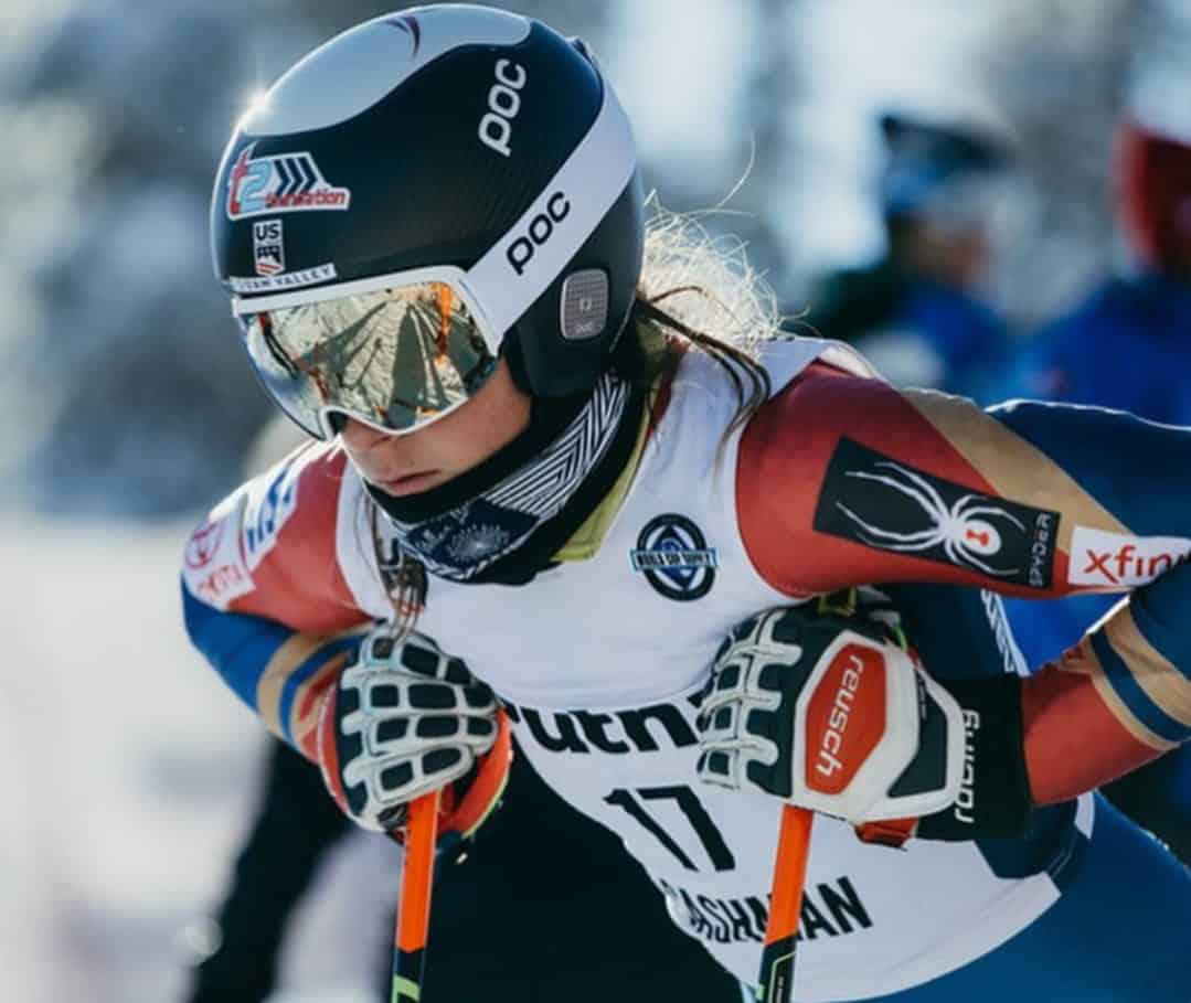 Keely Cashman: Wiki, Bio, Age, Family, Height, Boyfriend, Injury, College