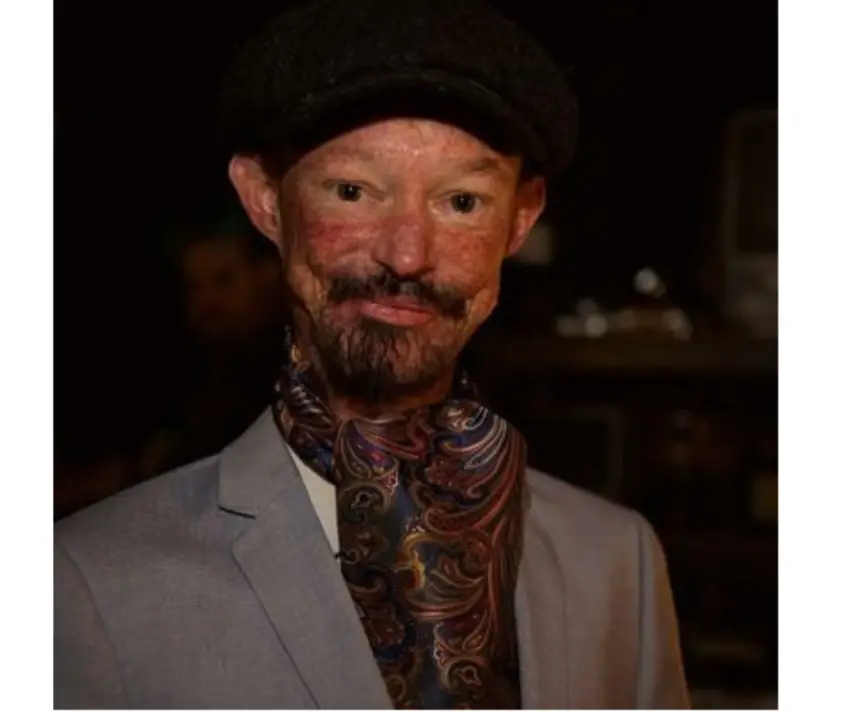 Darren Kent: Wiki, Bio, Age, Height, Wife, Illness, Career, Death